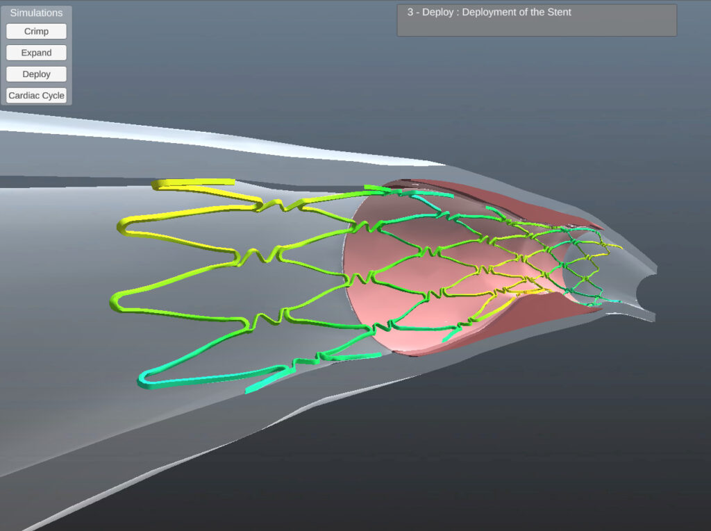 Your Turn! Interactive Online Experience: Stent