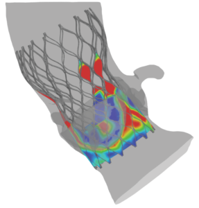 FEops社 【COMPASSマガジン】 - Dassault Systèmes blog